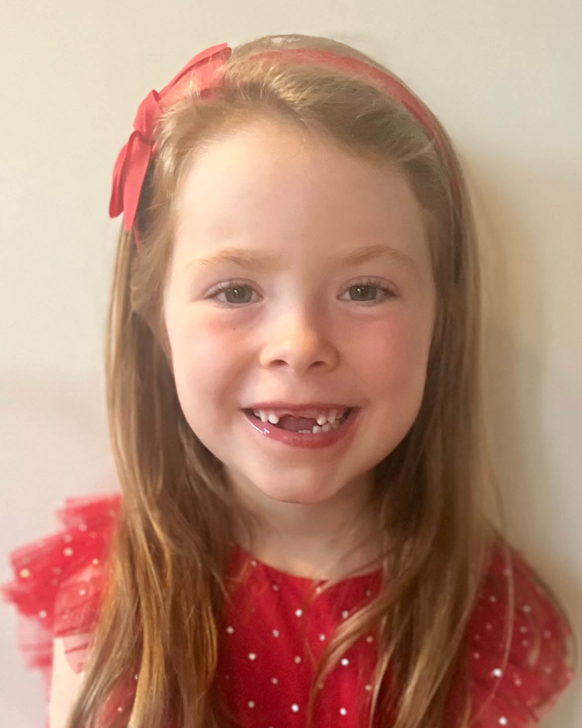 Rose Buds - Rose of Tralee